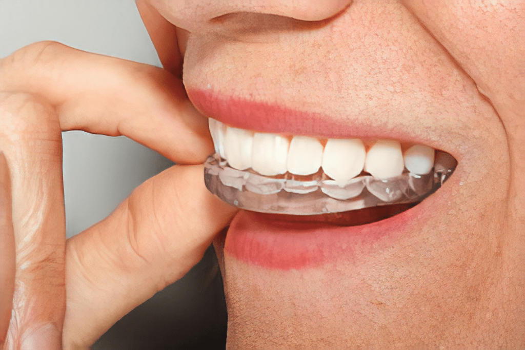 Diensten | Cari-dent